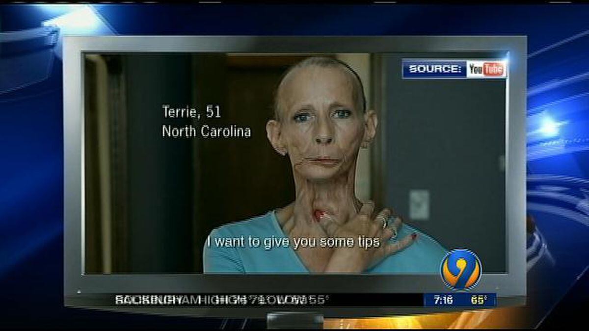 Woman featured in stark CDC anti-smoking ads dies