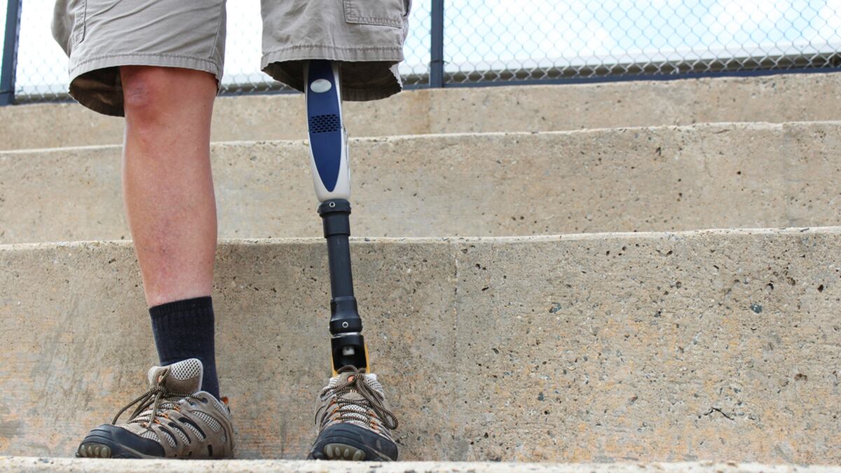 WATCH: Kids have adorable reaction to classmate's new prosthetic leg